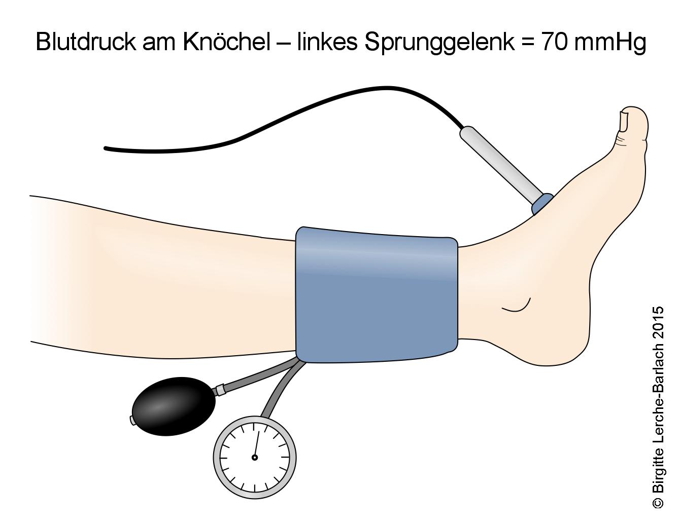 TeamPraxis | Arterielle Unterschenkel- oder Fußgeschwüre