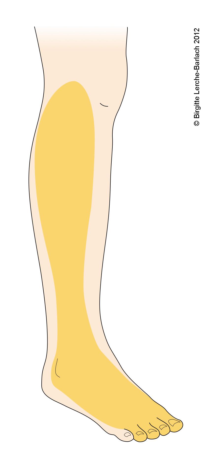 TeamPraxis | Peroneuslähmung